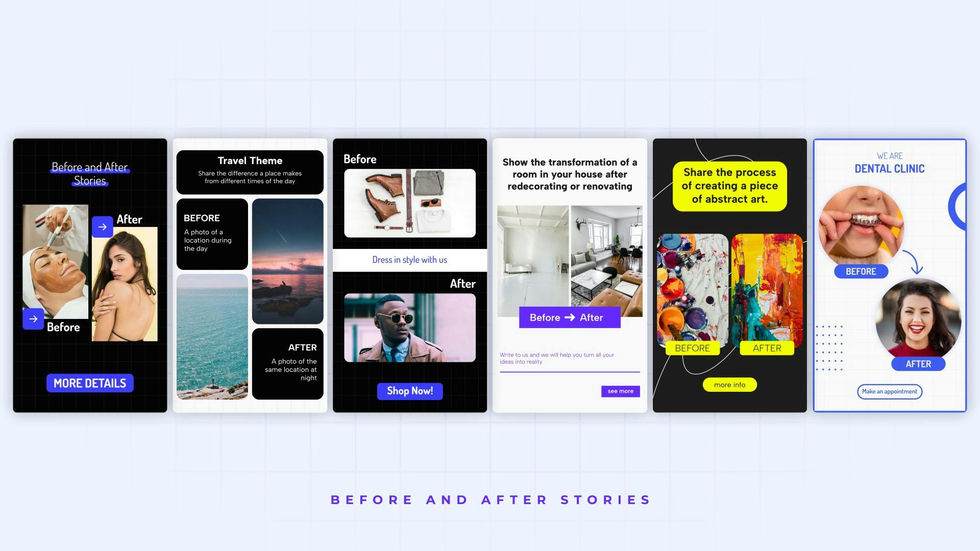 Before and After Stories video templates | Artlist